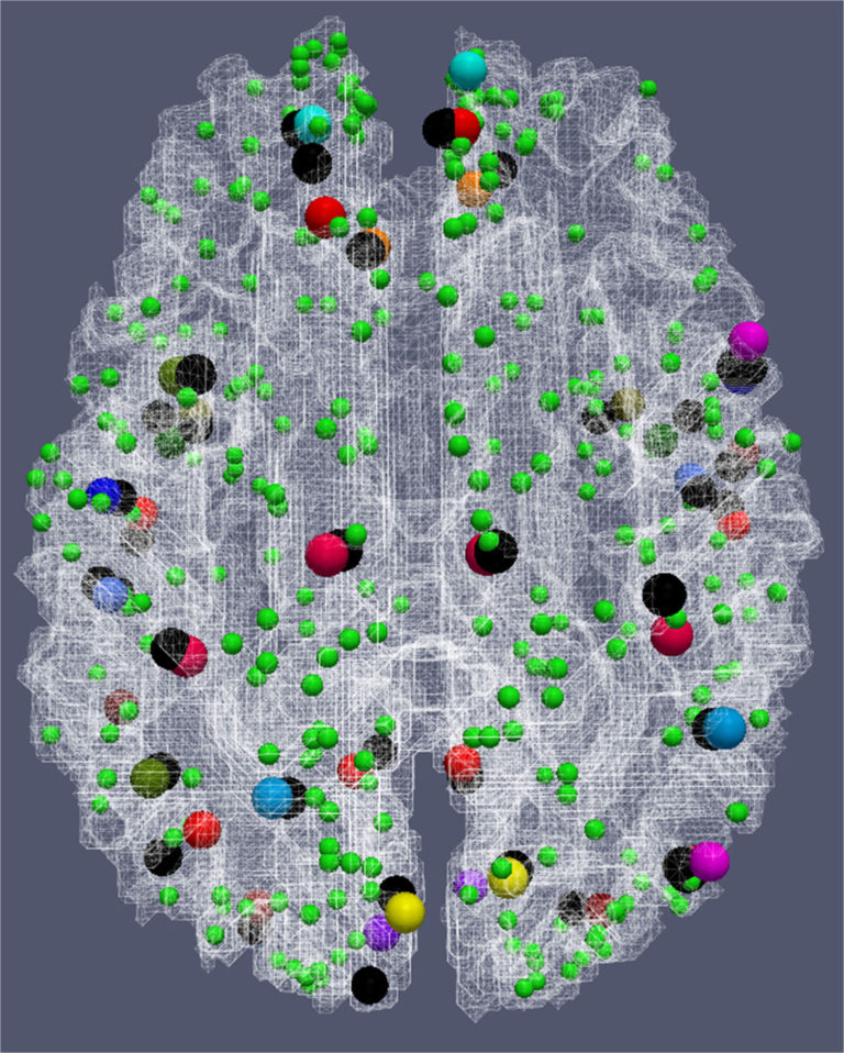 UGA researchers use new map of human brain to study dementia - UGA Today